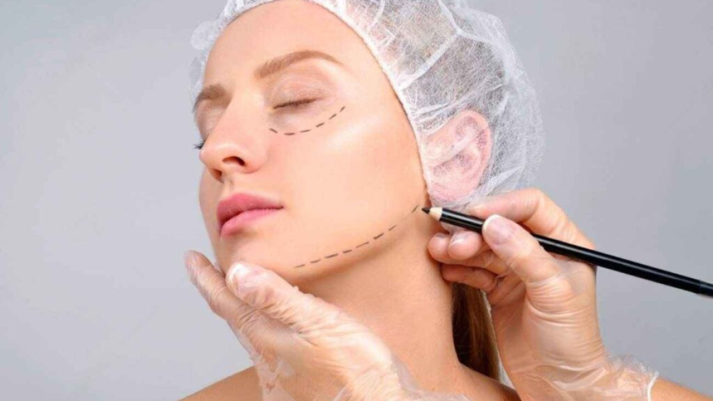 Dermato Surgery - Dermakalp